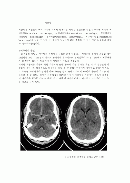 뇌출혈 (cerebral hemorrhage)