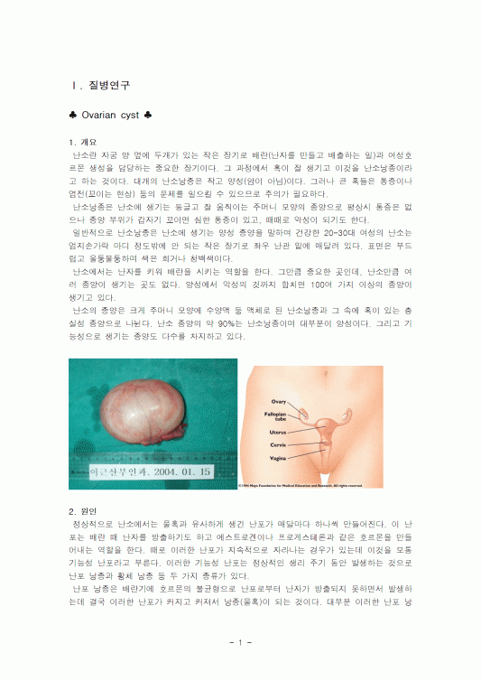 난소낭종 (문헌고찰, 간호과정, 각종검사)