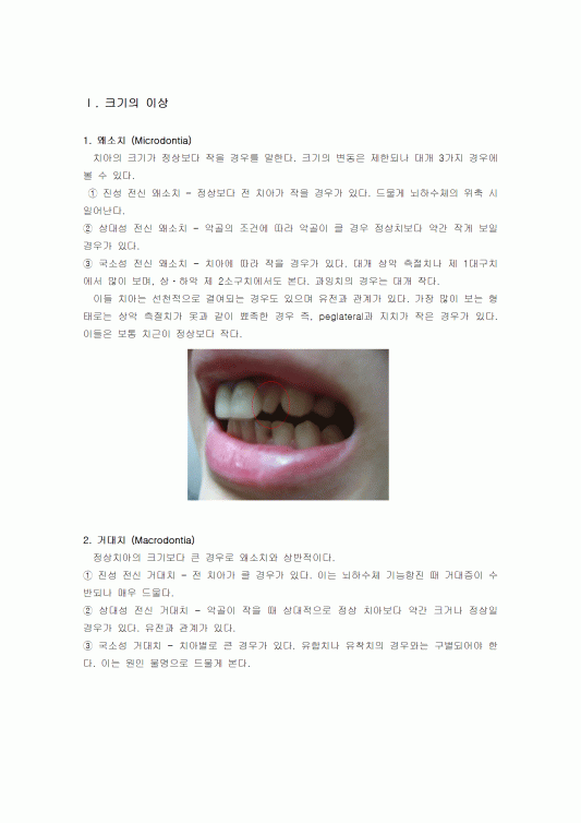 [치위생] 병리학-발육이상 치아
