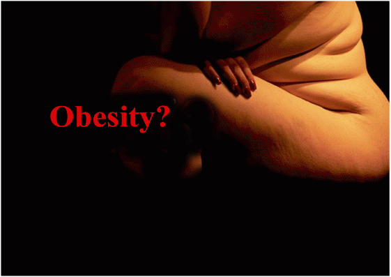 Obesity(비만)에 대한 조사