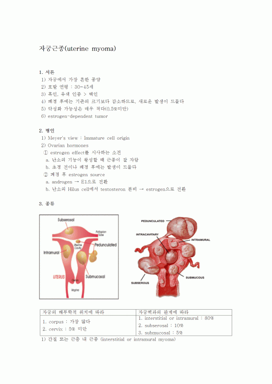 자궁근종(uterine myoma)