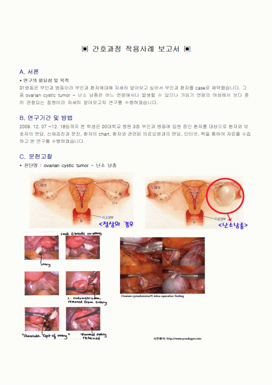case(ovarian cystic)