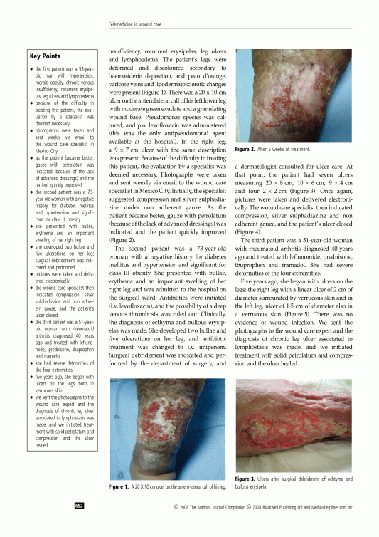 Telemedicine in wound care