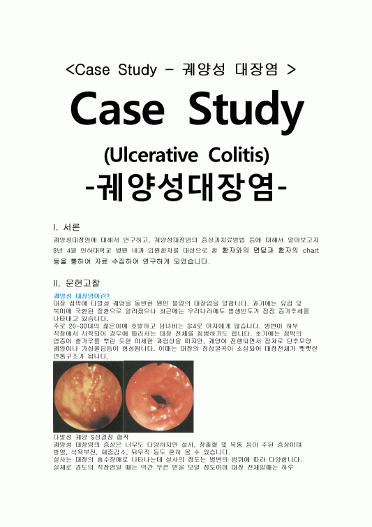[성인간호학][Ulcerative Colitis][궤양성대장염]문헌고찰, 케이스 스터디(Case Study)