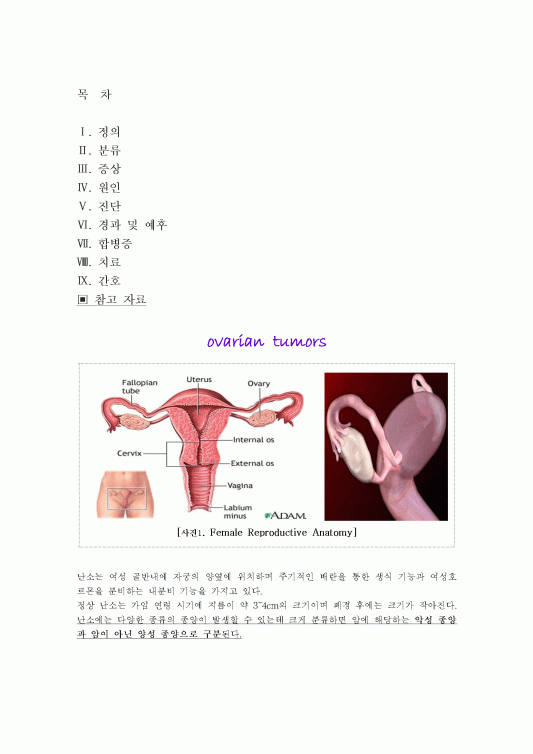 간호학 케이스 스터디 -난소종양(ovarian tumors)