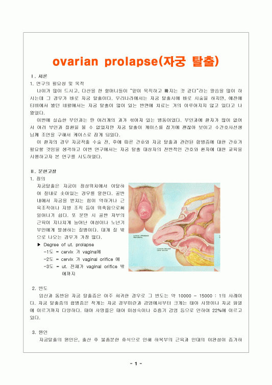 ovarian prolapse(자궁 탈출 케이스)
