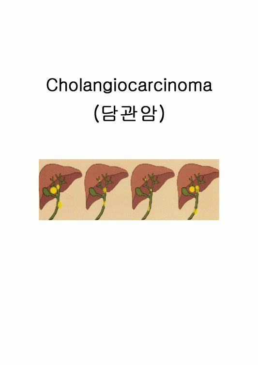 Cholangiocarcinoma(담관암)