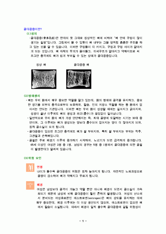 간호- 골다공증