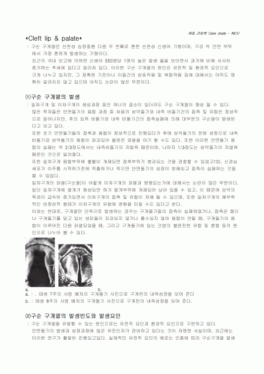 아동 간호학 Case study - 신생아중환자실 NICU - 구개파열