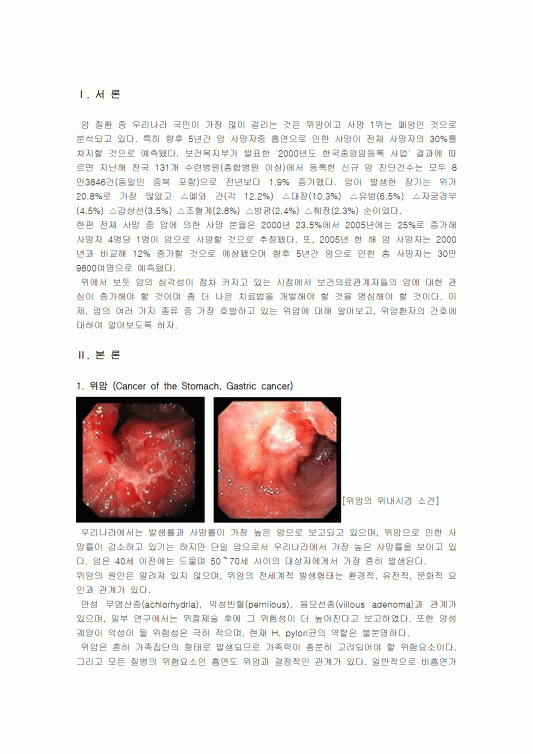 위암환자의 간호