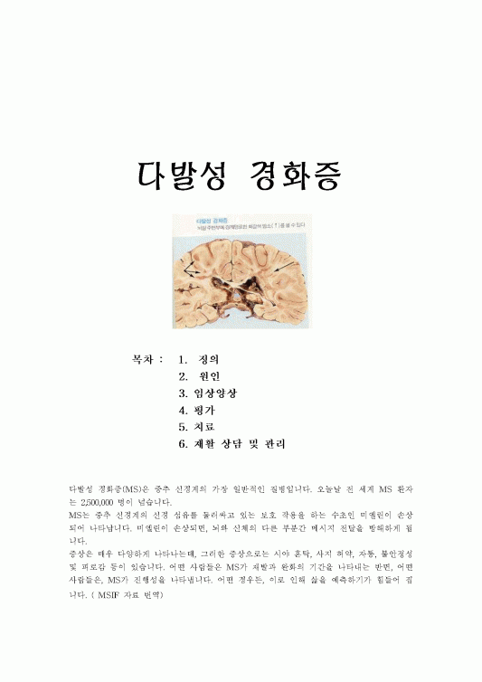 다발성 경화증 ( 정의 ,원인 ,임상양상 ,치료 ,재활상담및 관리)