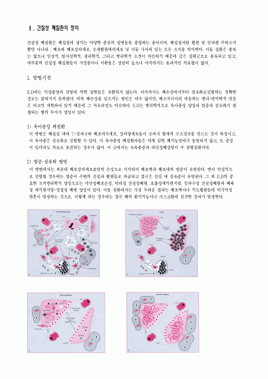 간질성 폐질환 ILD