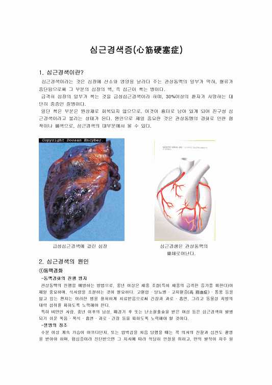 심혈관계질환 심근경색증