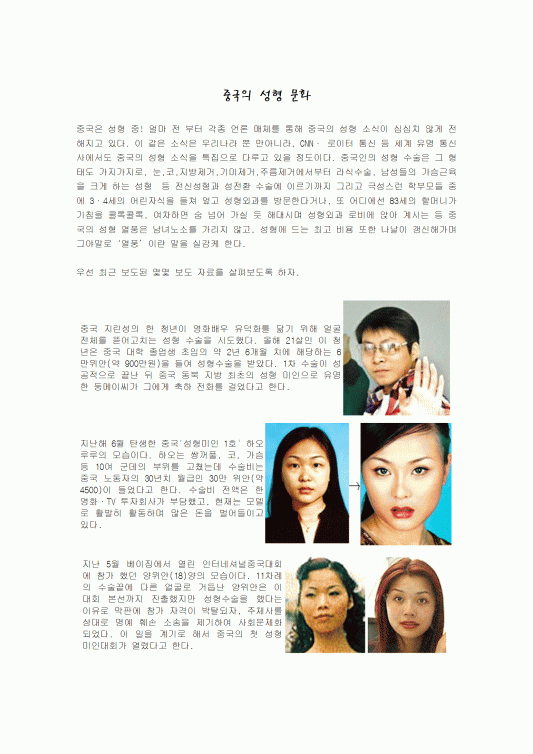 중국의 성형 문화