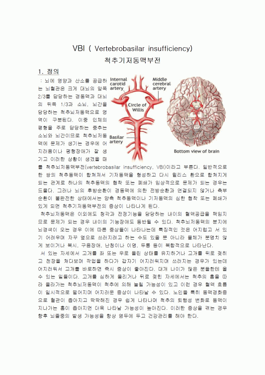 VBI 척추기저동맥부전
