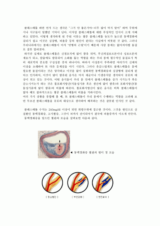 [의약학] 콜레스테롤
