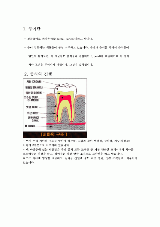 충치(진행, 예방과 치료, 보철 또는 충치 치료 후 시린 경우)