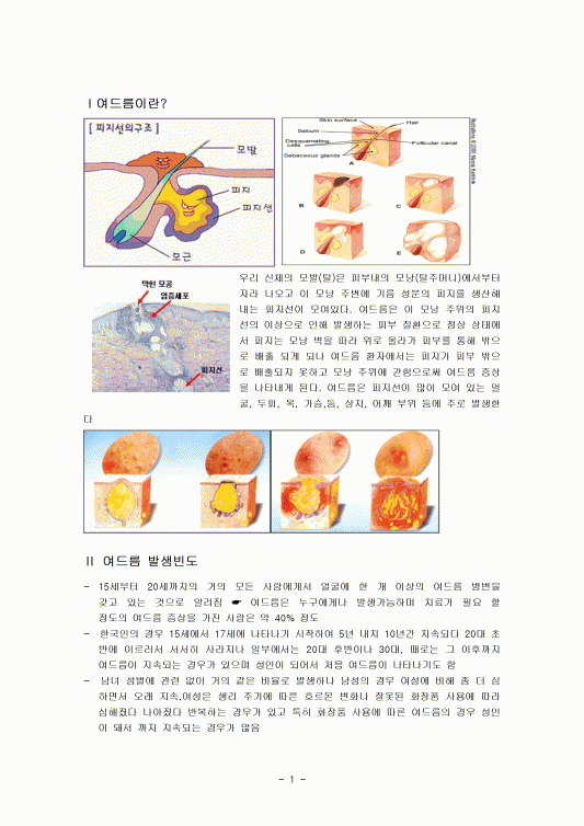 여드름의 원인과 관리 및 치료