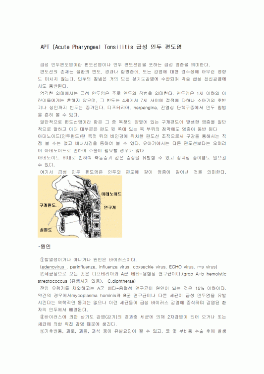 APT(Acute Pharyngeal Tonsilitis) 급성인두 편도염