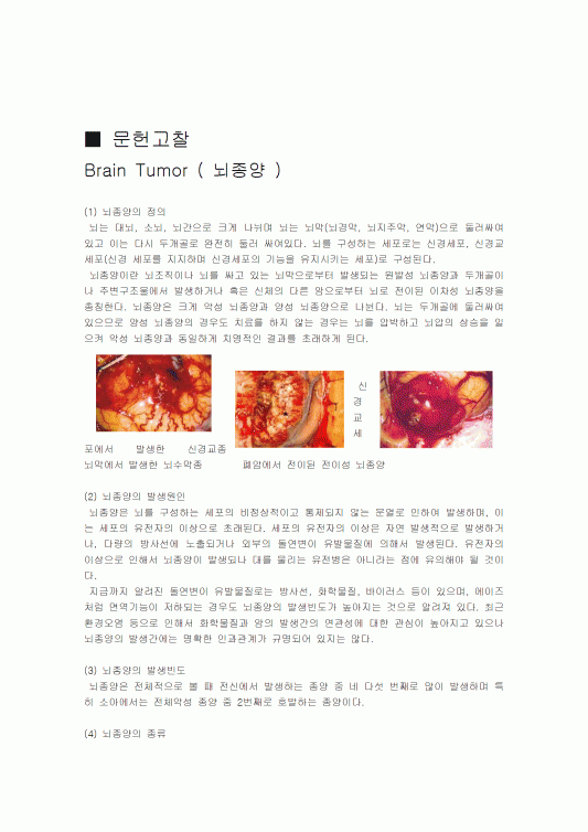 뇌종양케이스