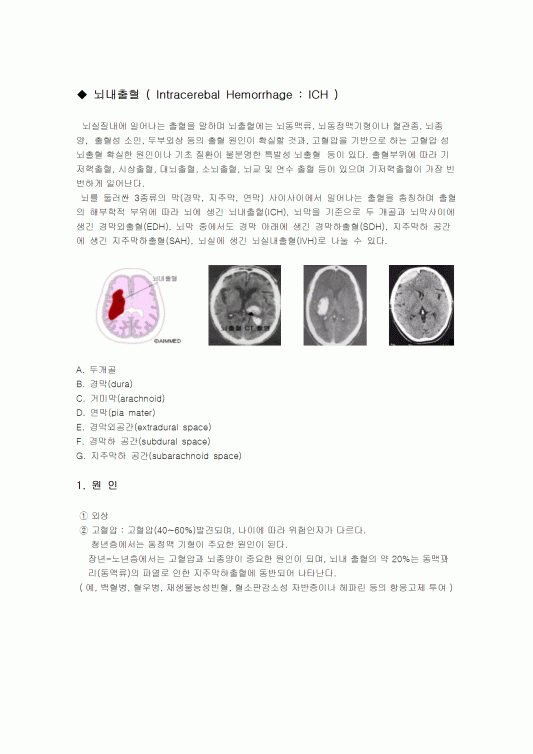 뇌내출혈 [논문]