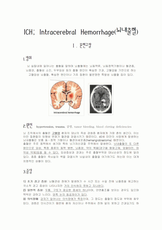 [의학논문] 뇌내출혈