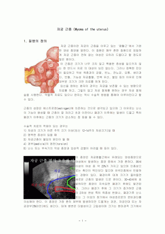 자궁근종 원인 질병 간호중재