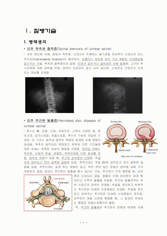 요추 척추관 협착증(Spinal stenosis of lumbar spine)case study