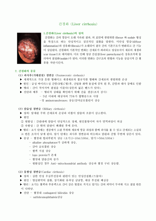 간경화 (Liver cirrhosis)