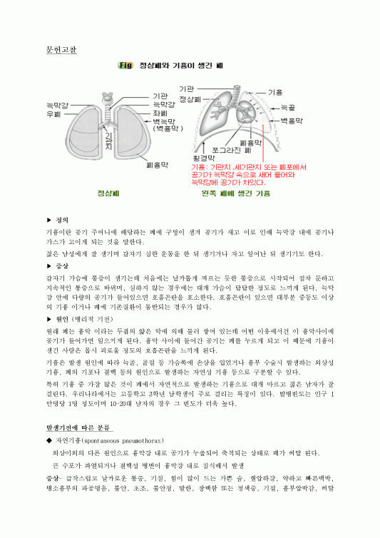 기흉 case 레포트 자료