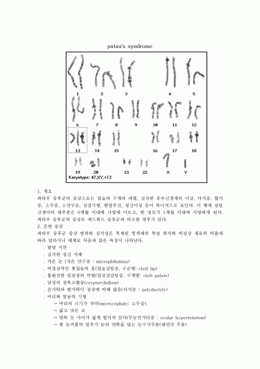 파타우증후군