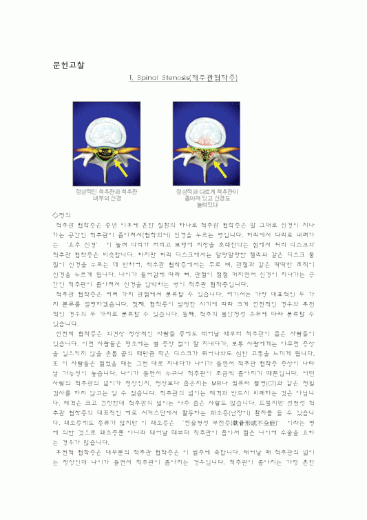 노인실습 문헌고찰(척추관협착증, 쇼그렌증후군)