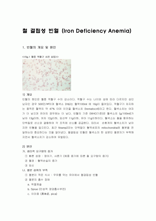 철결핍성 빈혈의 원인 및 예방과 치료
