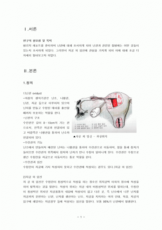 자궁 외 임신 레포트 자료