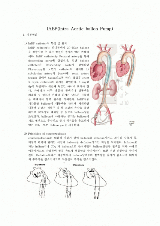 IABP(Intra Aortic ballon Pump)