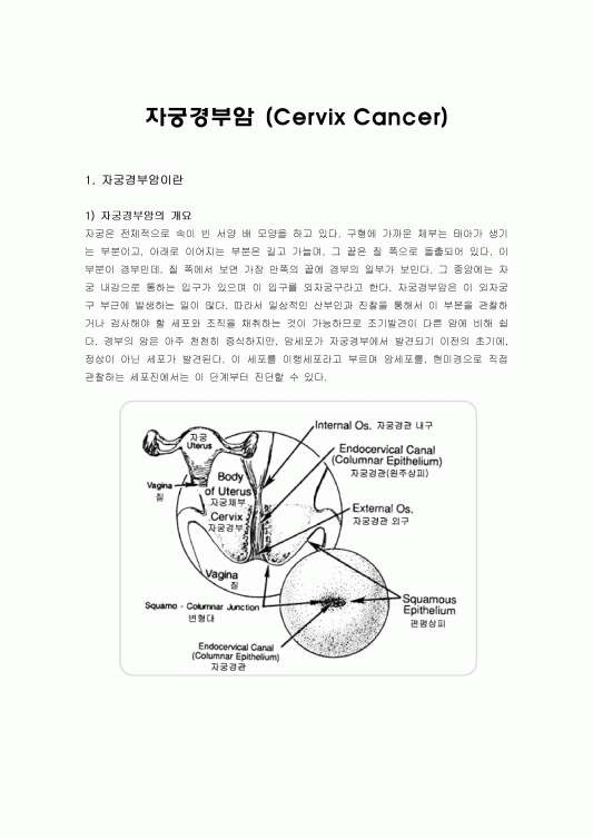 자궁경부암의 원인과 증상 및 치료