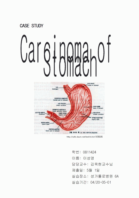[분석/조사] 위암 케이스