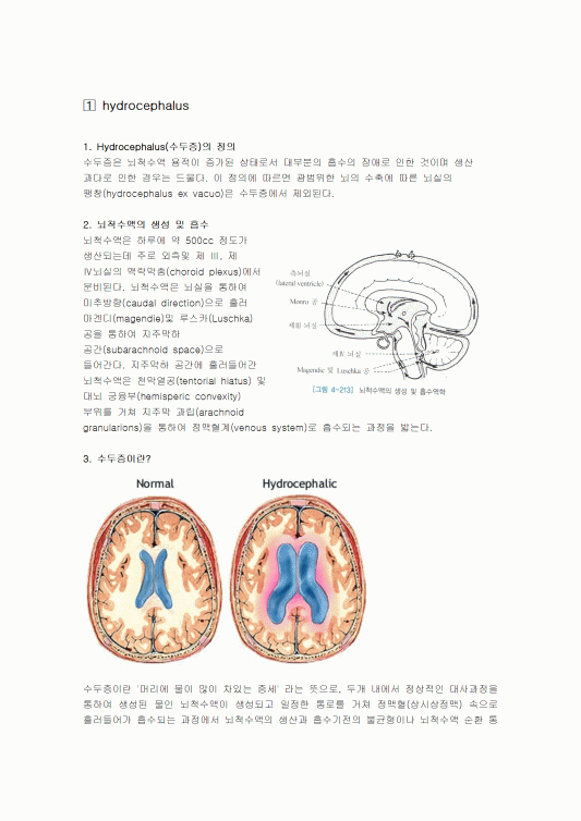 hydrocephalus 의 증상과 간호