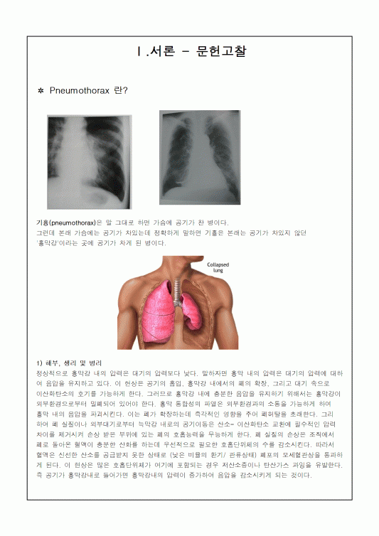 기흉 케이스 간호학과