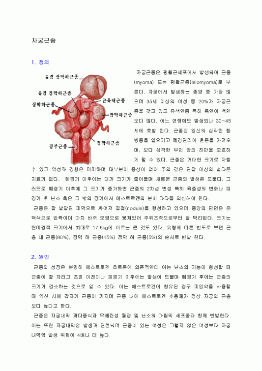 자궁근종의 증상과 진단 및 치료와 간호