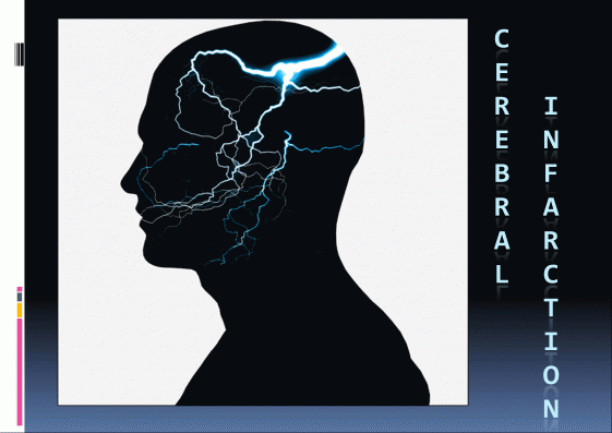 뇌경색(cerebral infarction) - 정의, 원인, 병리기전, 빈도, 분류, 증상, 검사 및 진단, 치료 및 간호중재