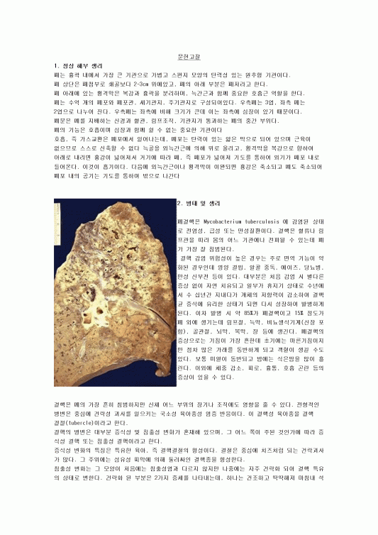 폐결핵 case study