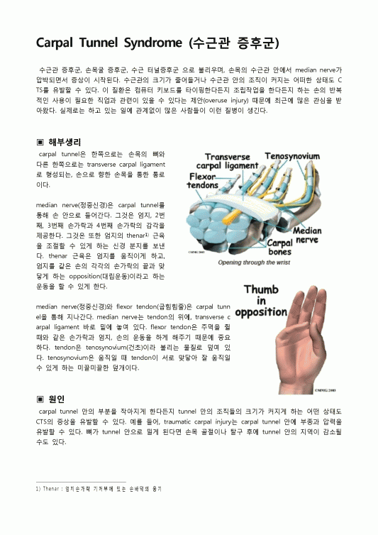 수근관 터널 증후군(carpal tunnel syndrome.CTS)