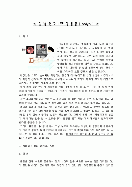 질병연구 대장용종( polyp )