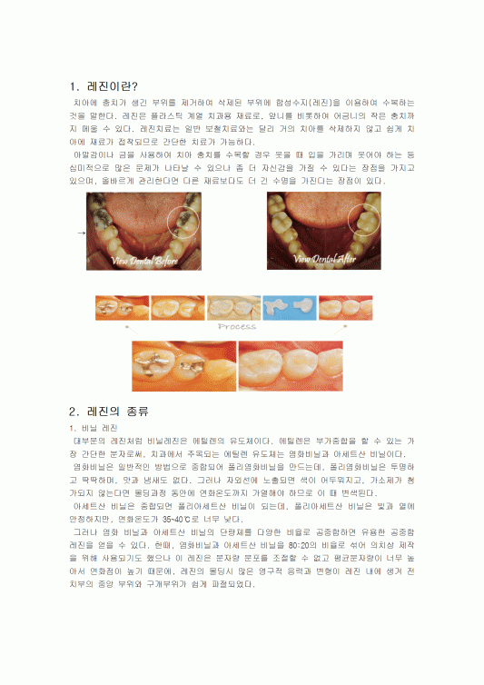 레진 레포트 자료