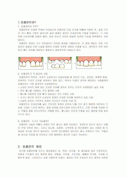 임플란트_리포트