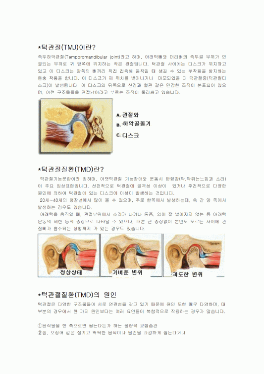 턱관절 레포트 자료