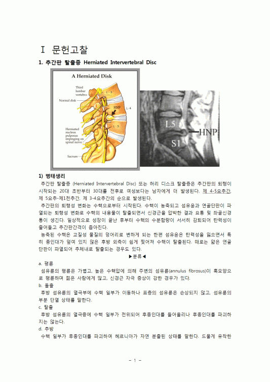 OS 추간판탈출증 척추분리증(Herniated Intervertebral Disc) 케이스 스터디