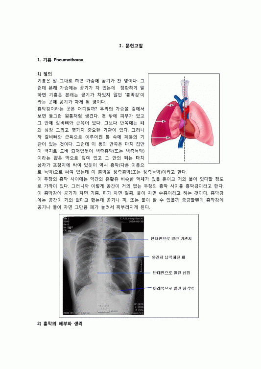 기흉컨퍼런스