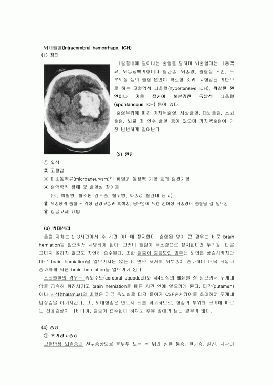 [의학] 뇌내출혈[intracerebral hemorrhage, ICH]